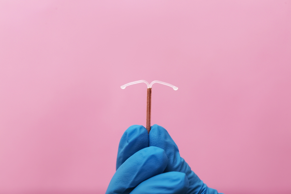 IUD - Women's Health Group Chicago